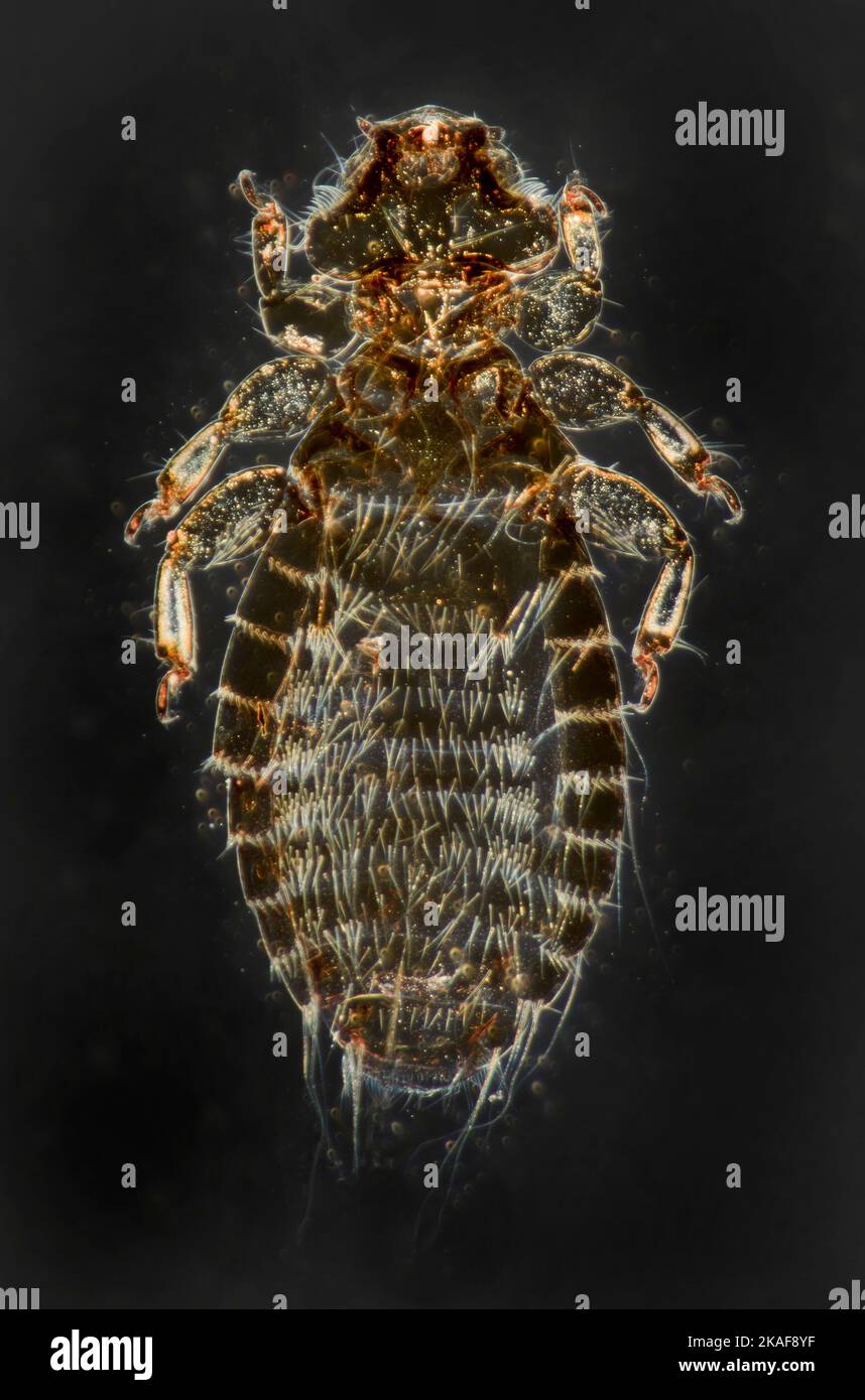 Bird louse, from a Jackdaw, darkfield photomicrograph Stock Photo - Alamy