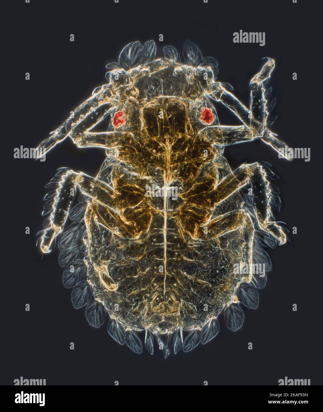Maple aphid, leaf insect, Periphyllus sp. darkfield photomicrograph ...