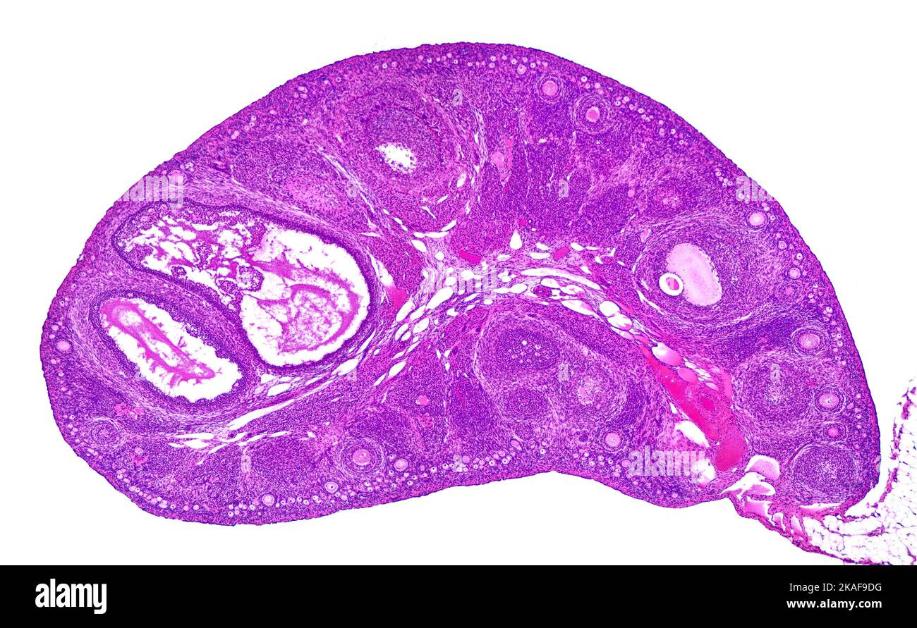 Human ovary stained section, brightfield photomicrograph Stock Photo ...