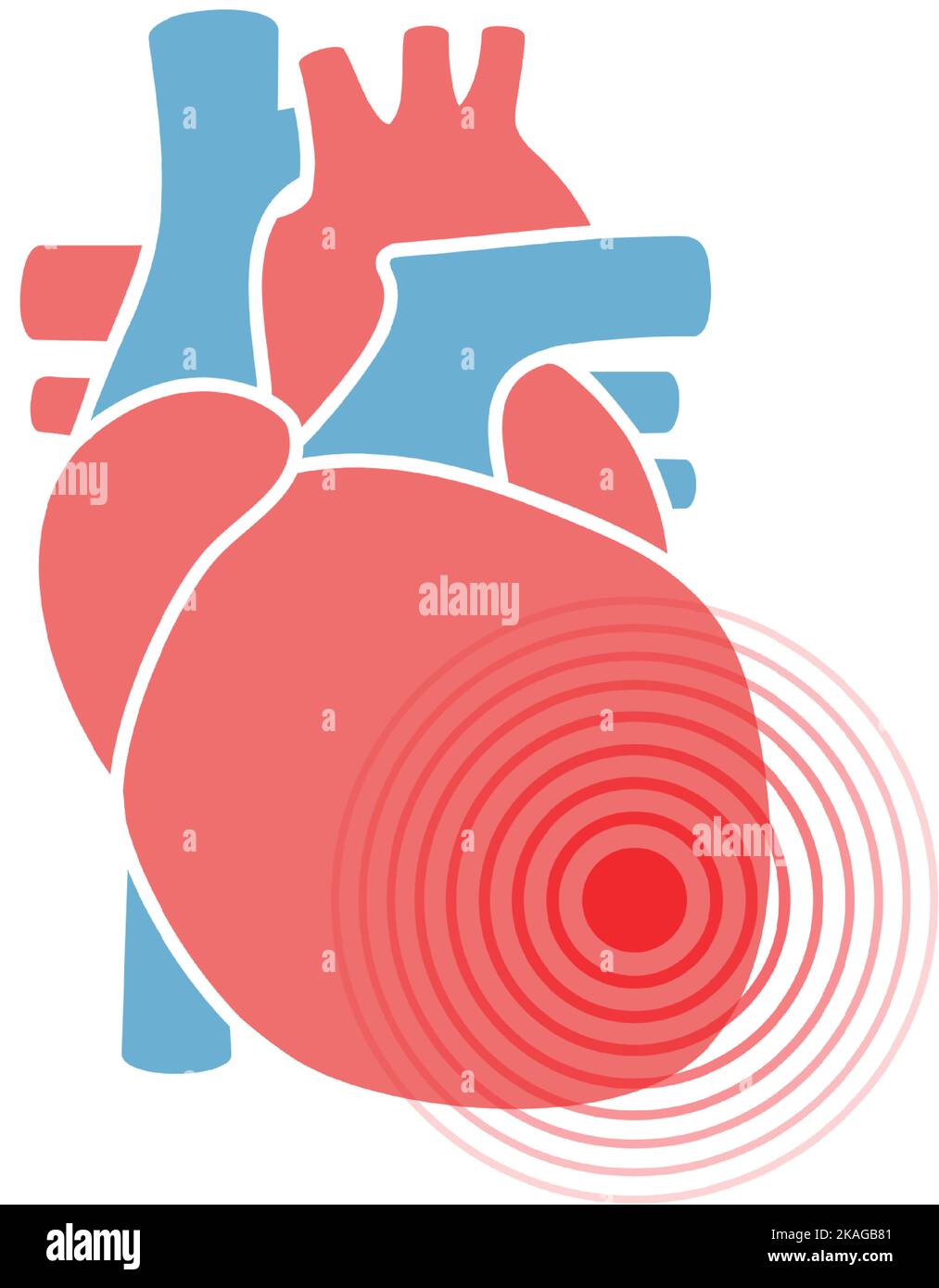 Human heart pain symbol. Heart ache icon. Vector illustration. Human ...