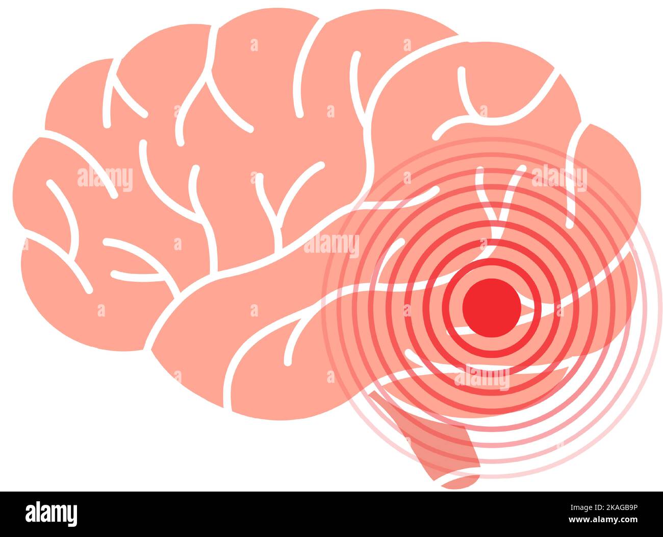 Human brain pain symbol. Brain ache icon. Vector illustration. Human ...