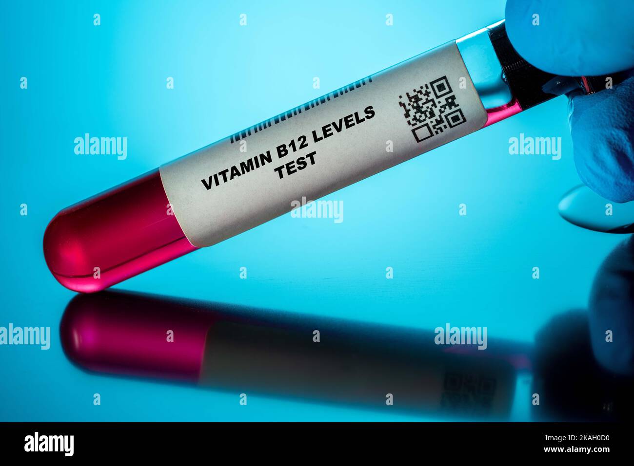 Vitamin b12 levels test hi-res stock photography and images - Alamy