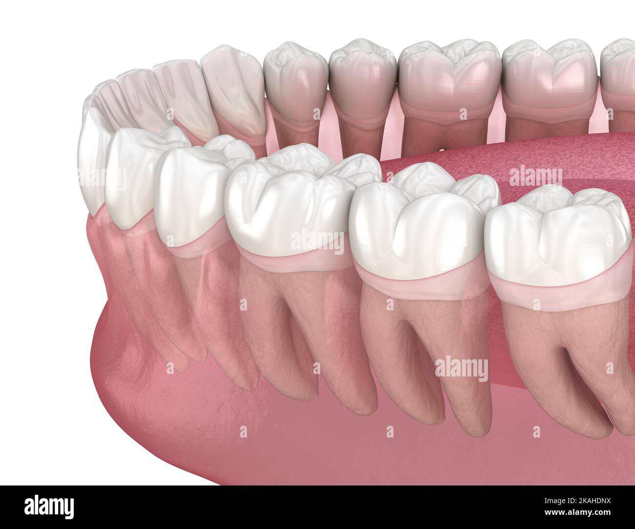 Morphology of human teeth. Medically accurate tooth 3D illustration ...