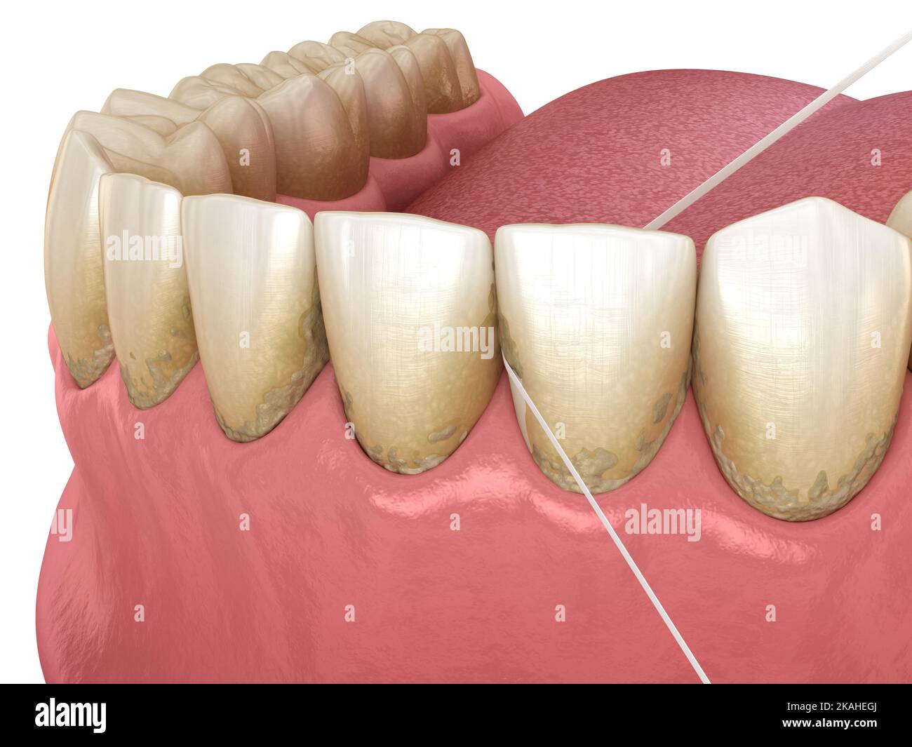 Dental floss cleaning process. Medically accurate dental 3D ...