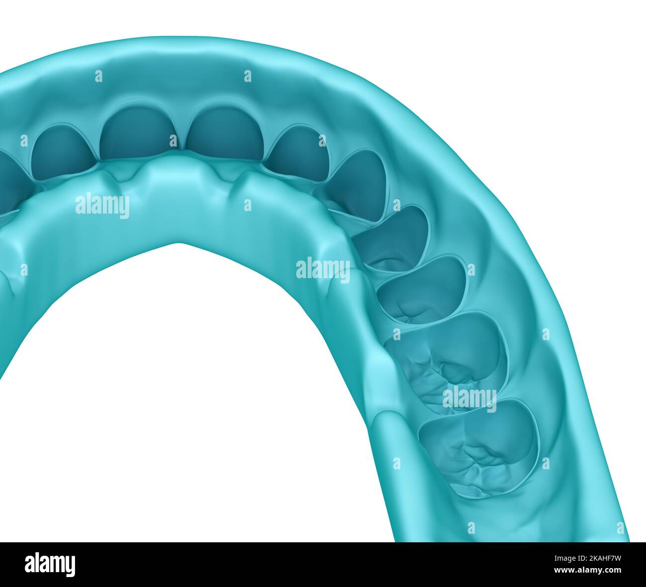 Mock-up dental key. Treatment Planning. Medically accurate tooth 3D ...