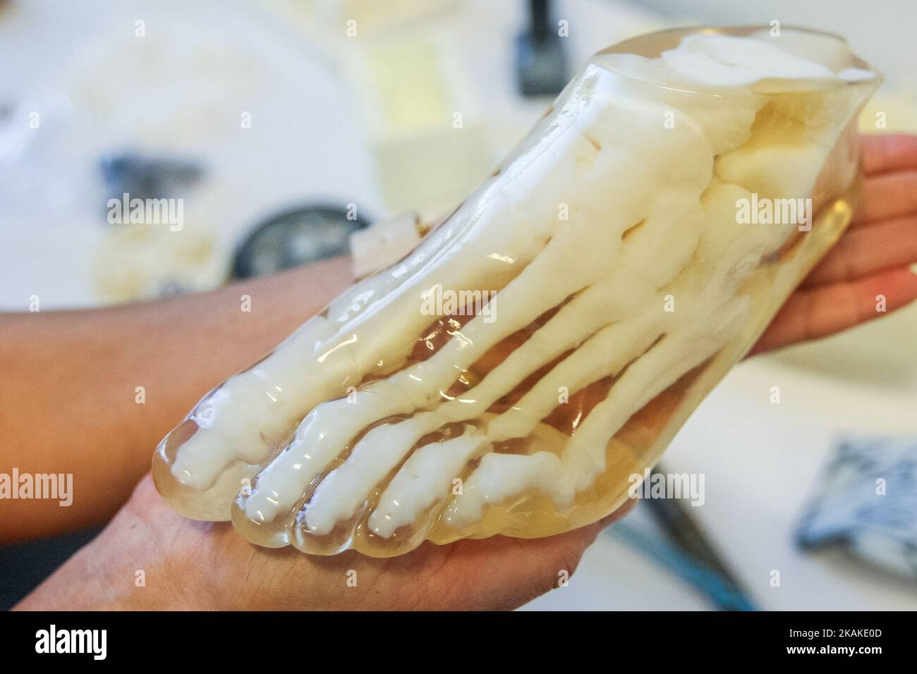 3D printed medical human foot model is seen in Pomeranian Science and ...