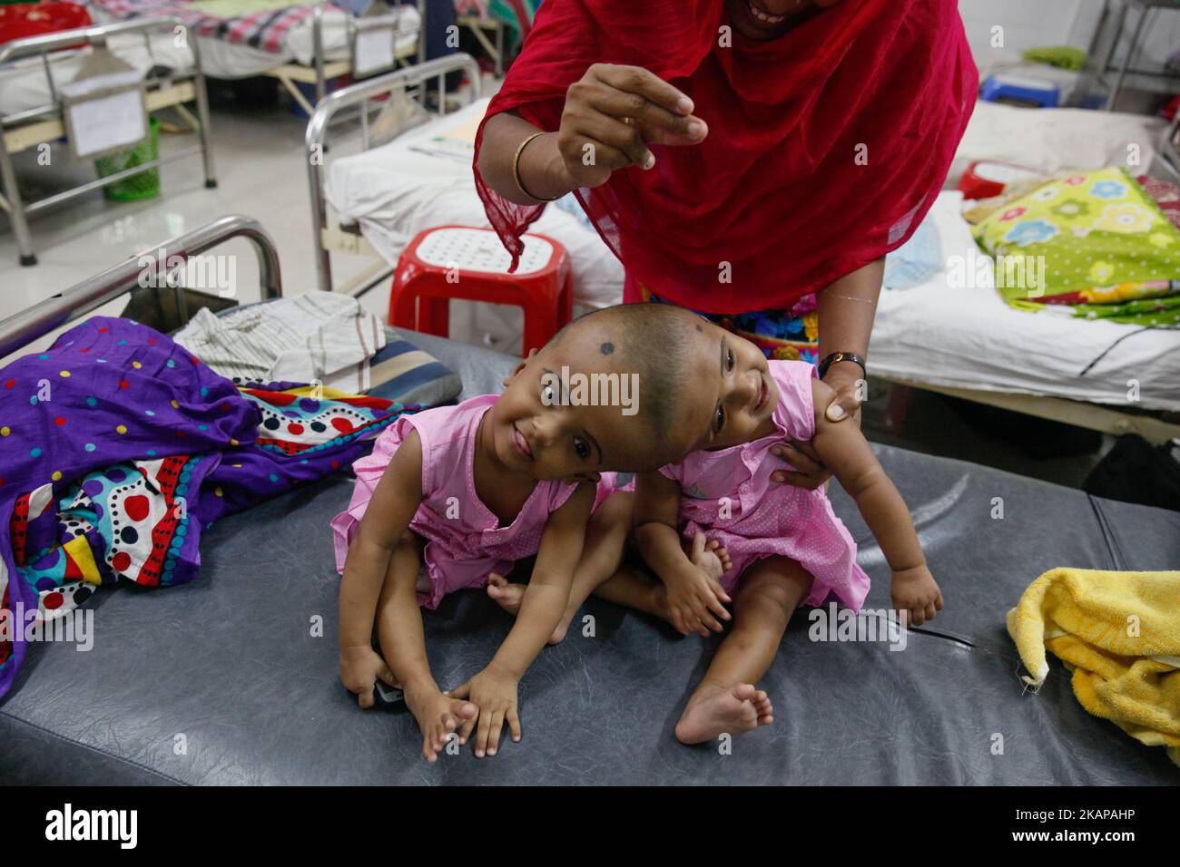 Bangladeshi conjoined baby girls twins Rabia and Rukia admitted in ...