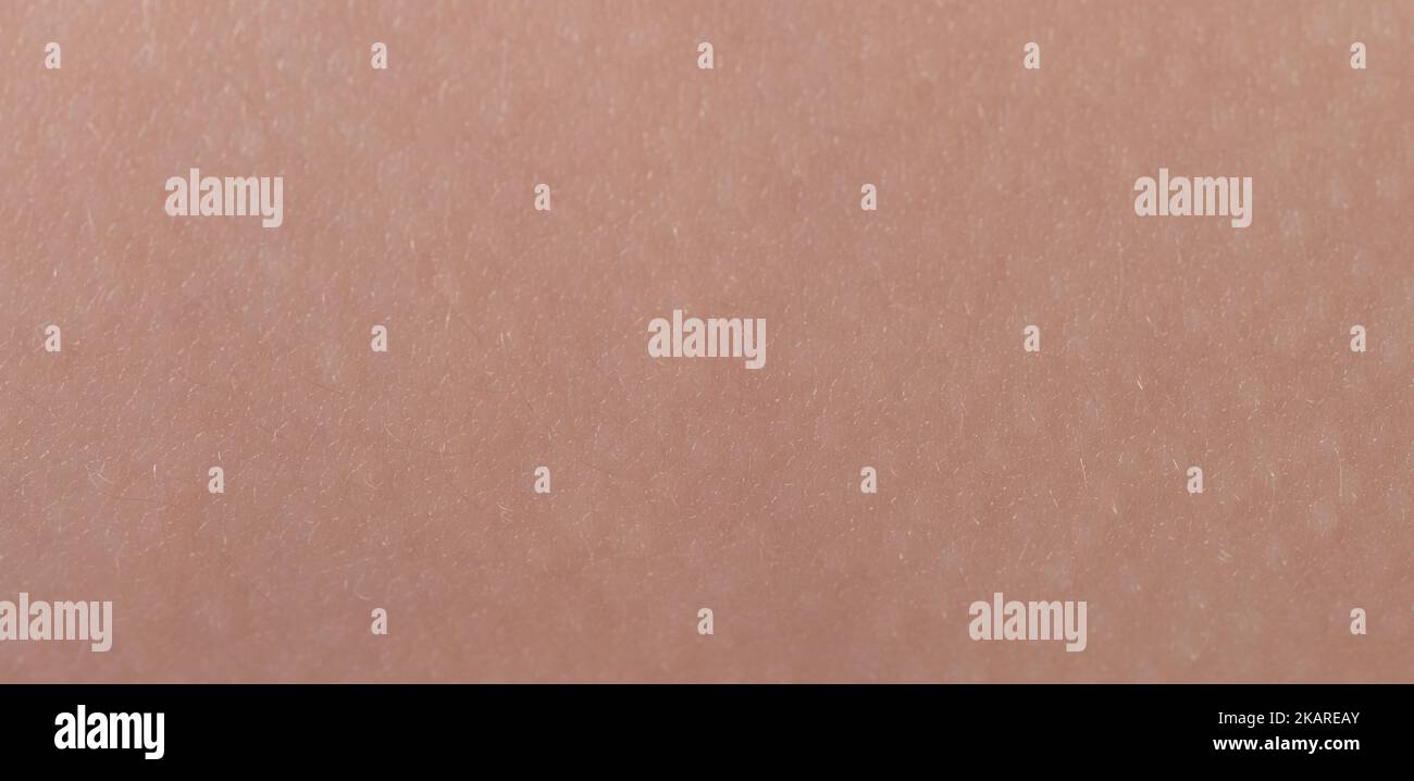 Goosebump on clean human skin macro close up view Stock Photo - Alamy