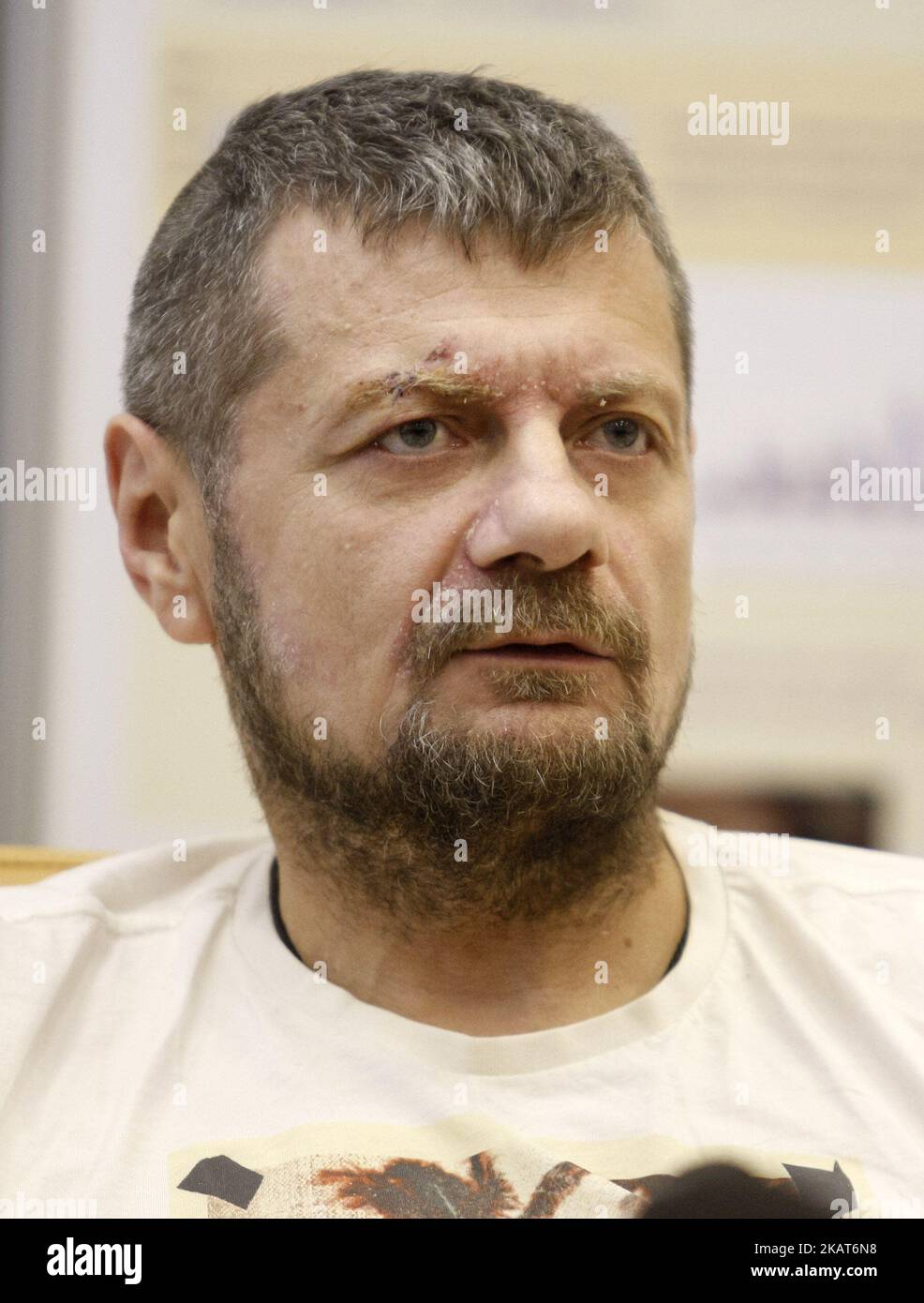 Igor Mosiychuk, Ukrainian lawmaker, speaks with journalists during a ...