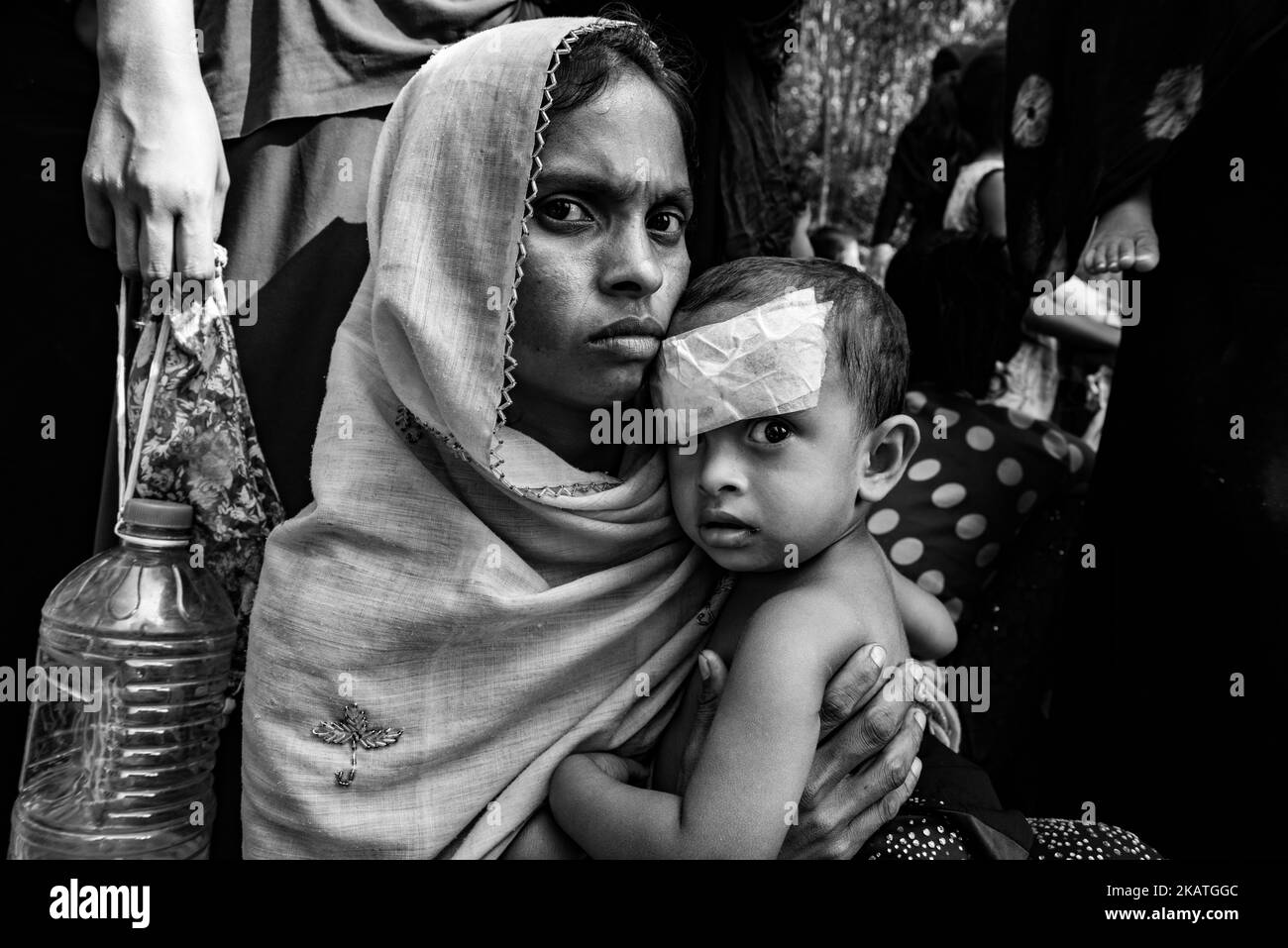 The Rohingya refugee woman holds her young child with with head injury ...