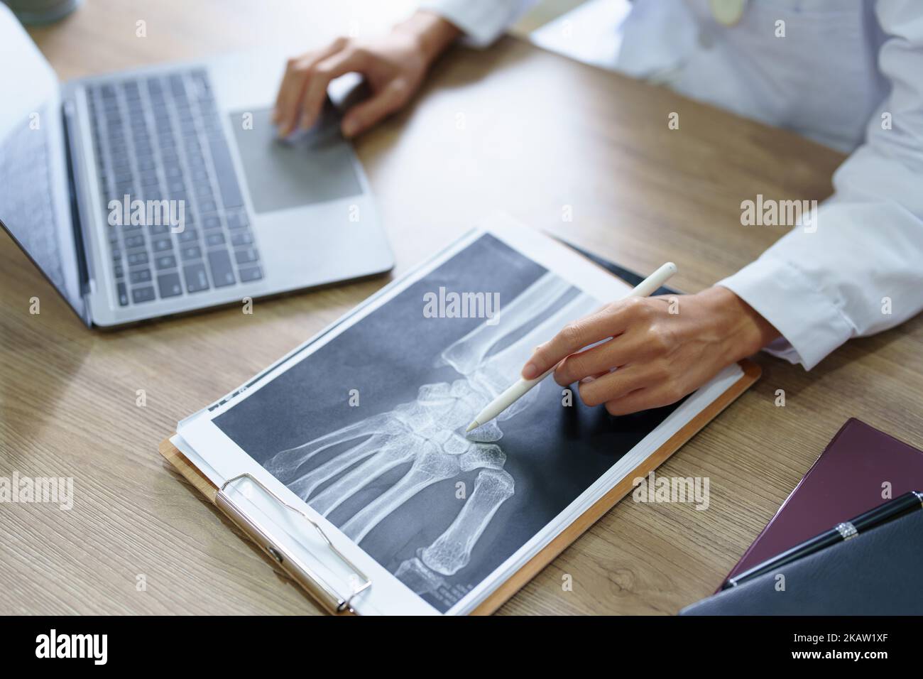 Asian female doctor is analyzing patient data from x-ray film and using ...
