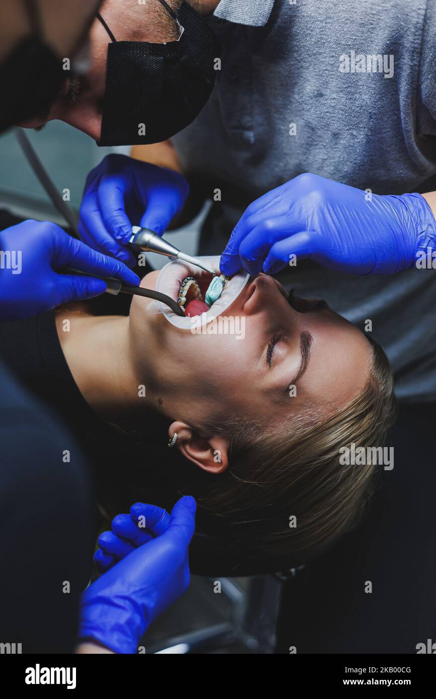 Orthodontic treatment of teeth. The doctor installs metal braces on the ...