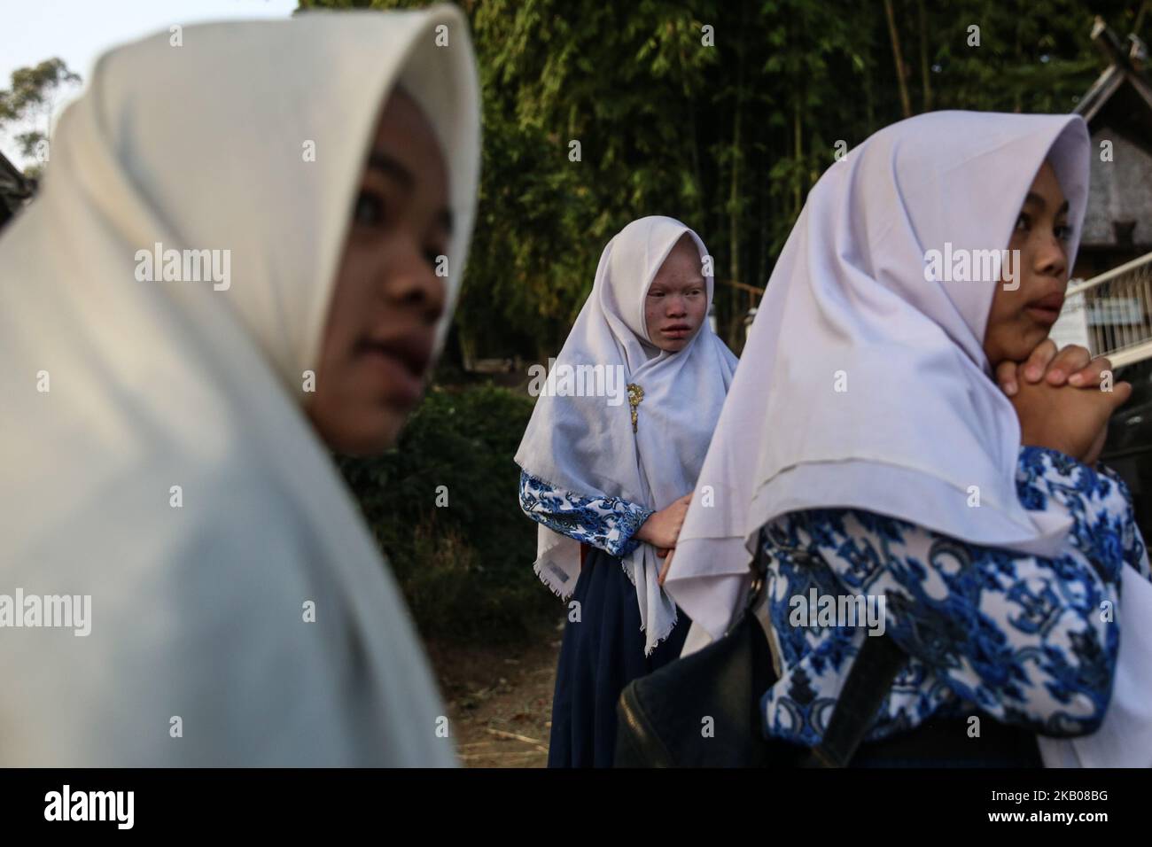 Dewi Resmana, 13, who has albinism gets ready for school with his ...