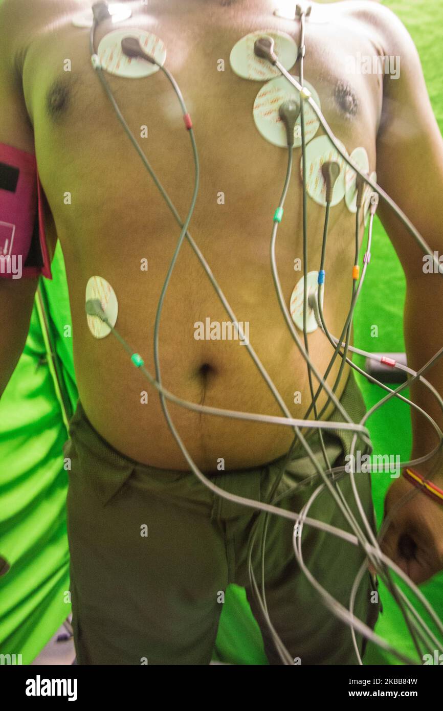 A man undergoing an Exercise Stress Test walking and running on a ...