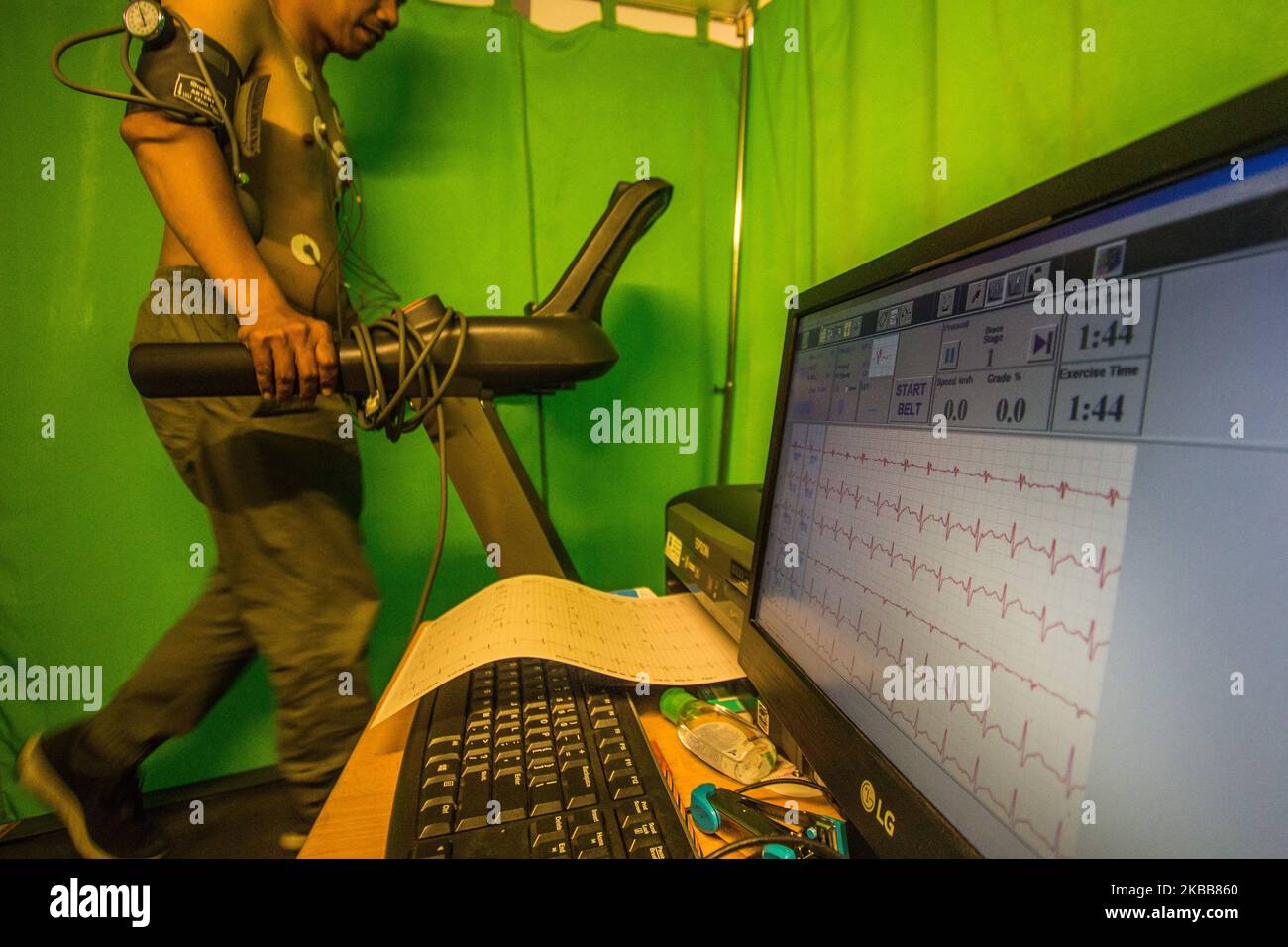 A man undergoing an Exercise Stress Test walking and running on a ...