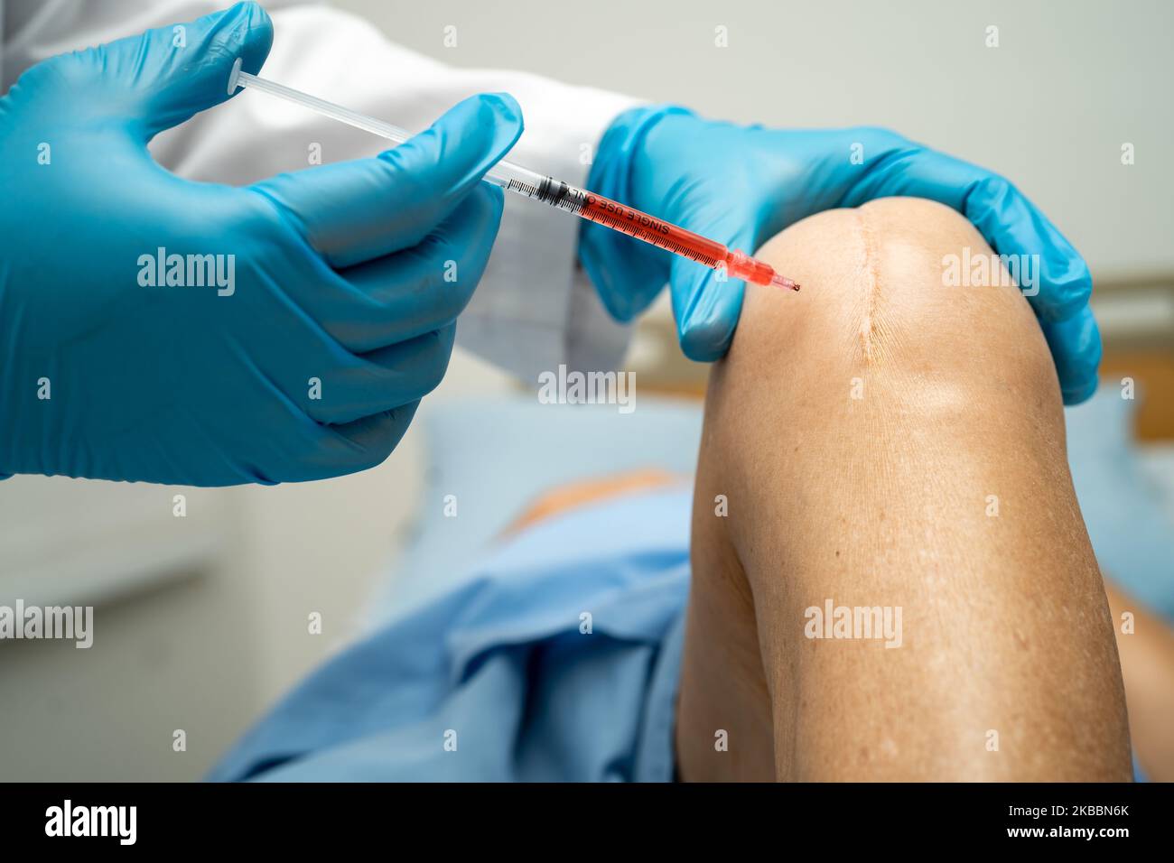 Hyaluronic knee hi-res stock photography and images - Alamy