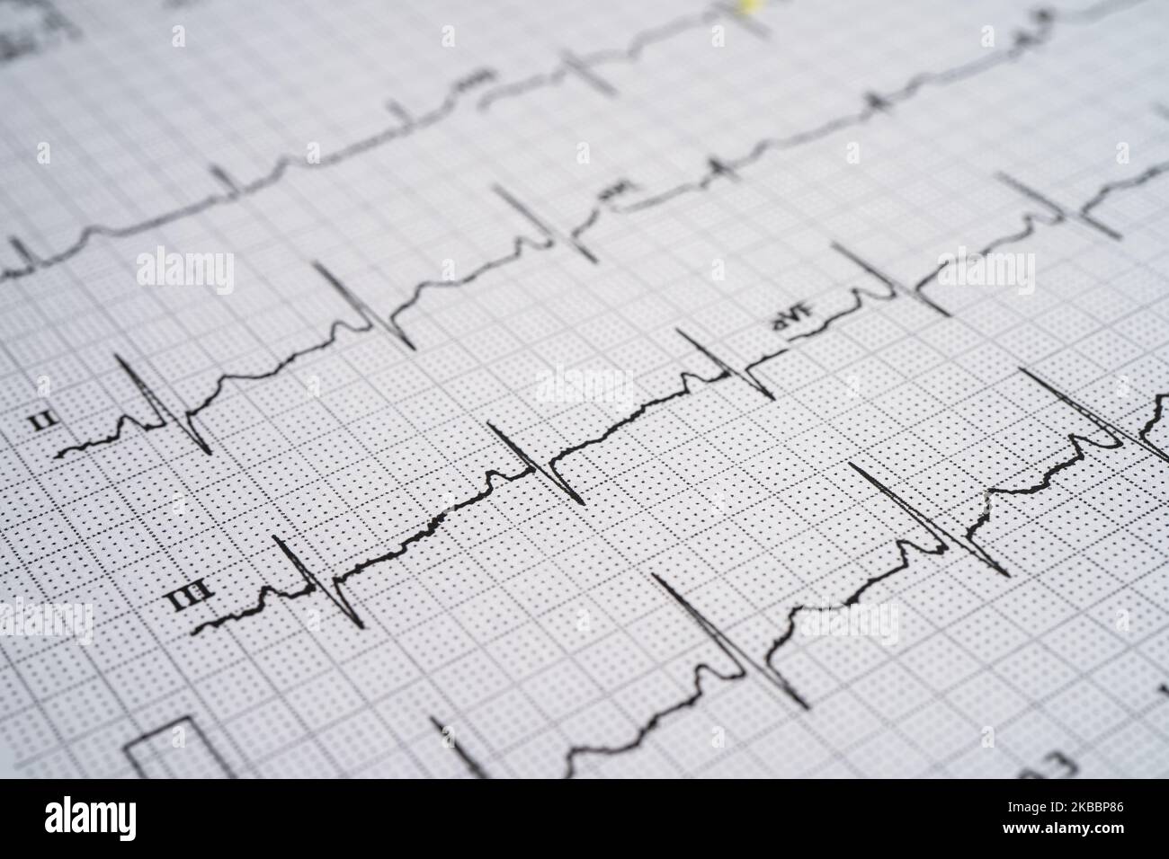 Electrocardiogram ECG with red heart, heart wave, heart attack, cardiogram report Stock Photo ...
