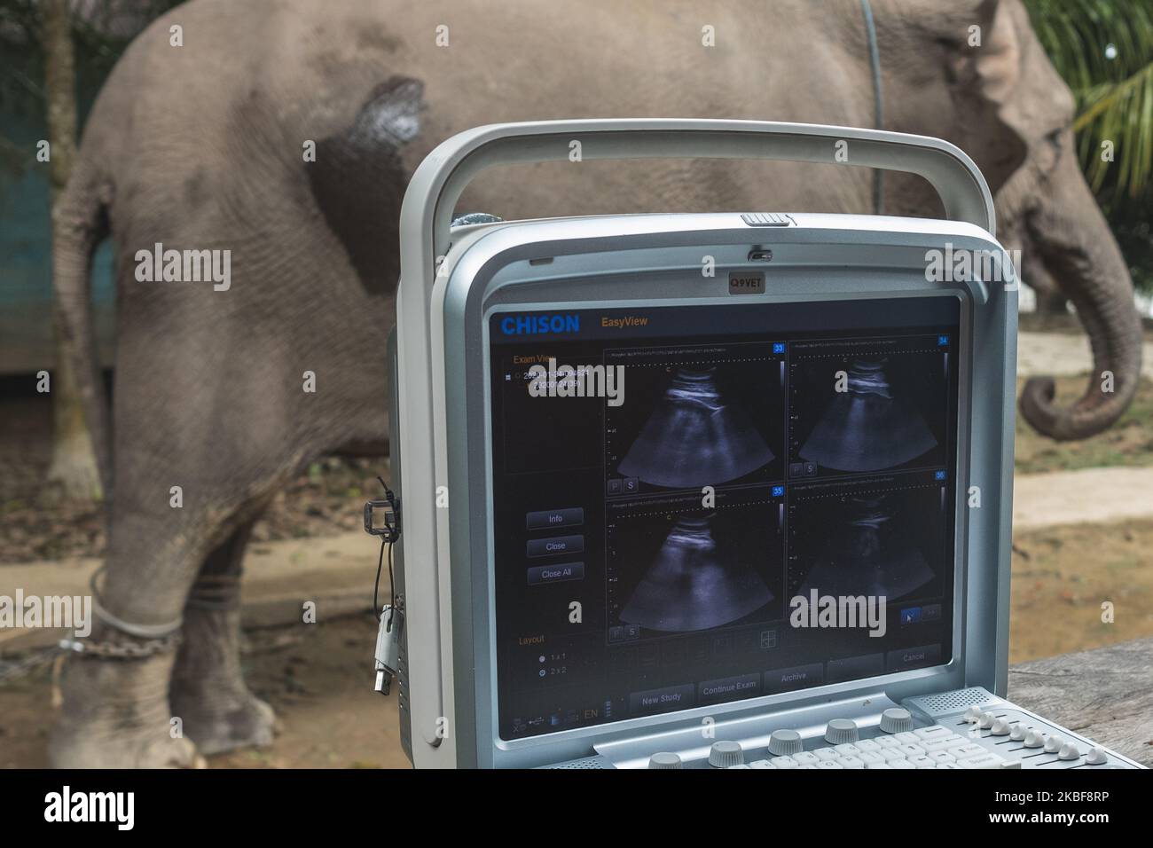 Ultrasound scan old foetus hi-res stock photography and images - Alamy