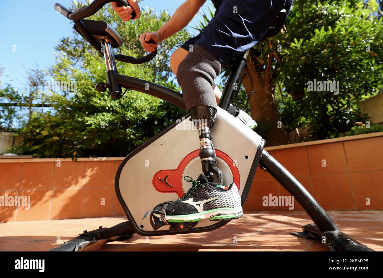 Prosthetic leg after hi-res stock photography and images - Alamy