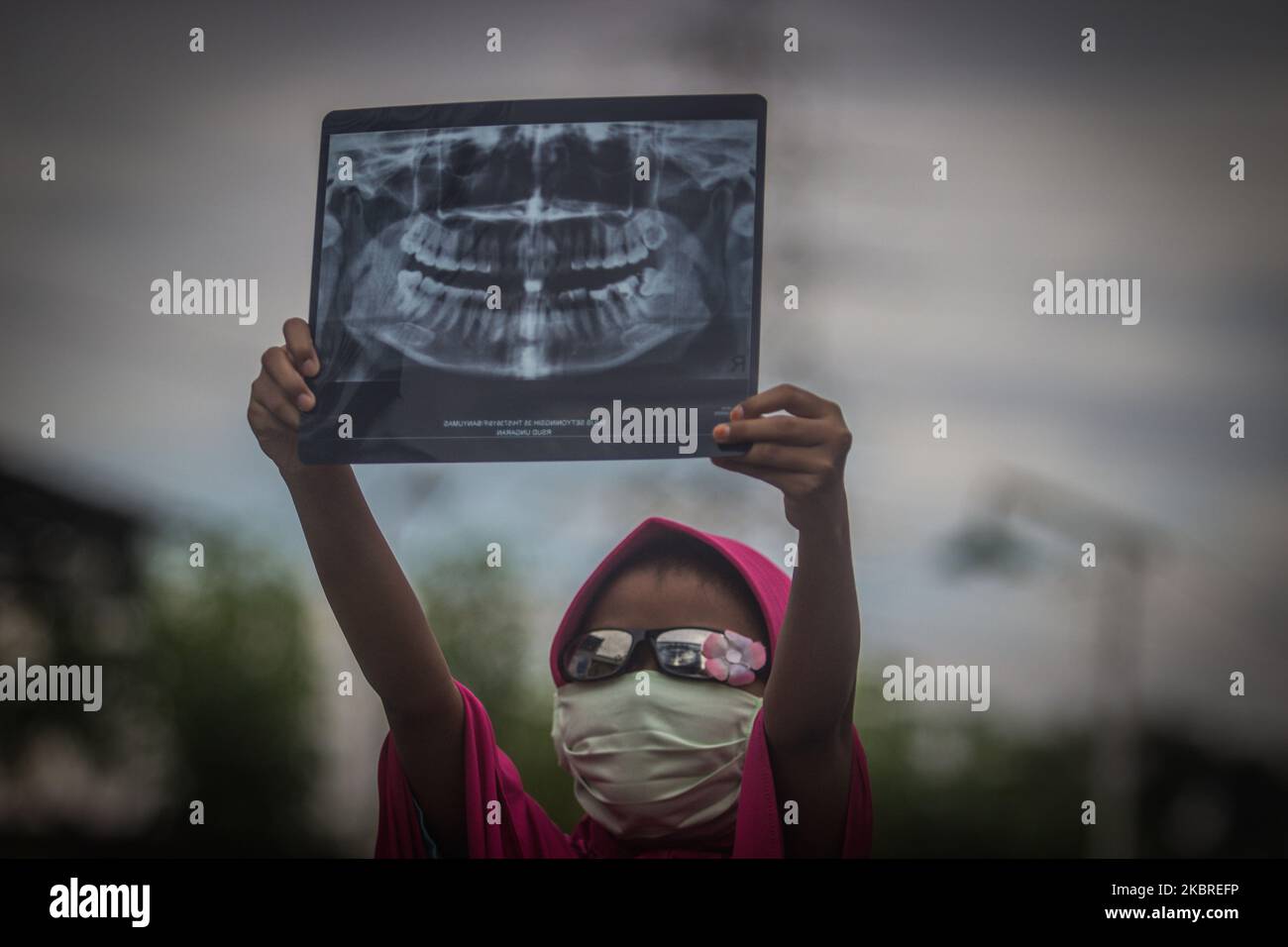 A girl watches a solar eclipse through a X-ray as the moon covers the sun in a rare "ring of ...