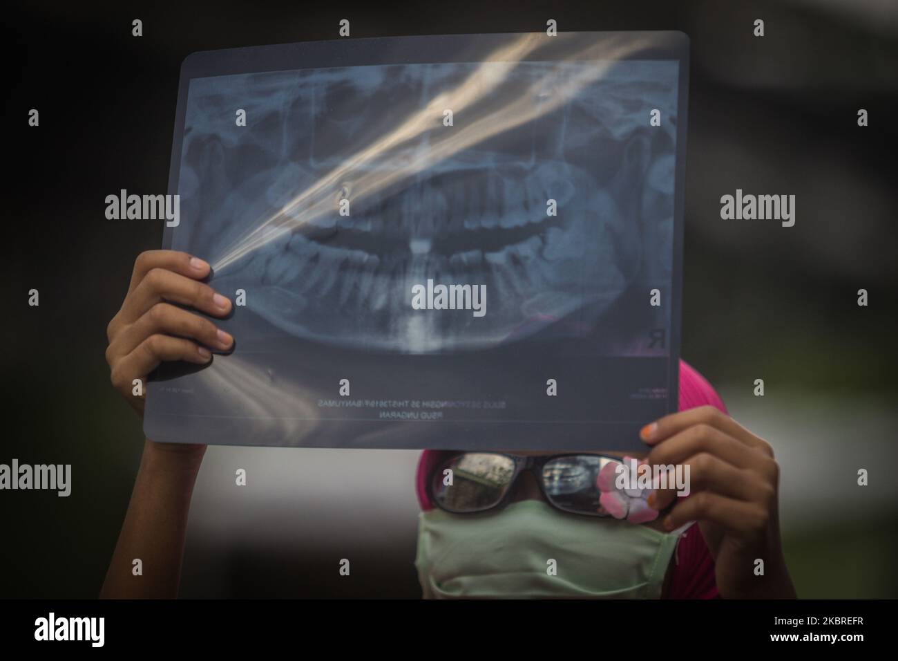 A girl watches a solar eclipse through a X-ray as the moon covers the sun in a rare "ring of ...