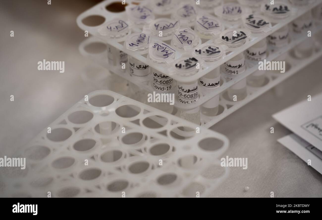 New coronavirus (COVID-19) testing tubes are pictures in a virology ...