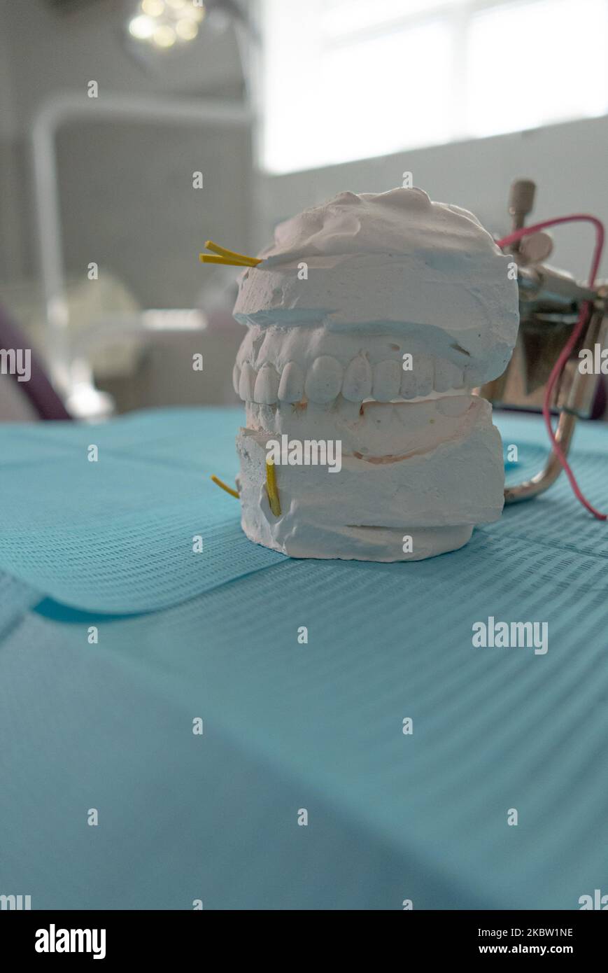 Orthodontic model - artificial jaws closeup with orthodontic cabinet on ...