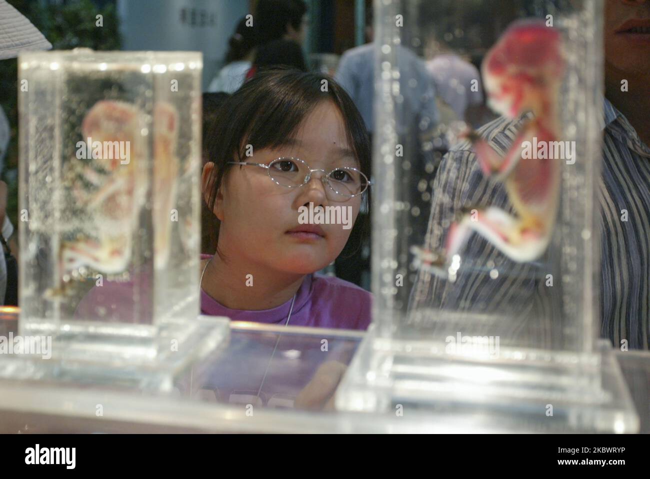 A Visitors look real human body during The Real Body Exhibition in ...