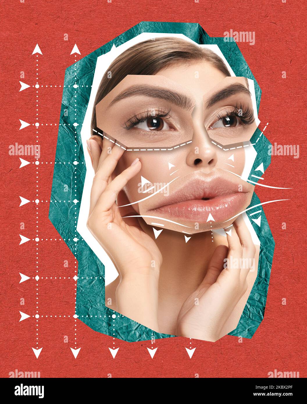 Contemporary art collage. Young woman doing face botox, lip ...