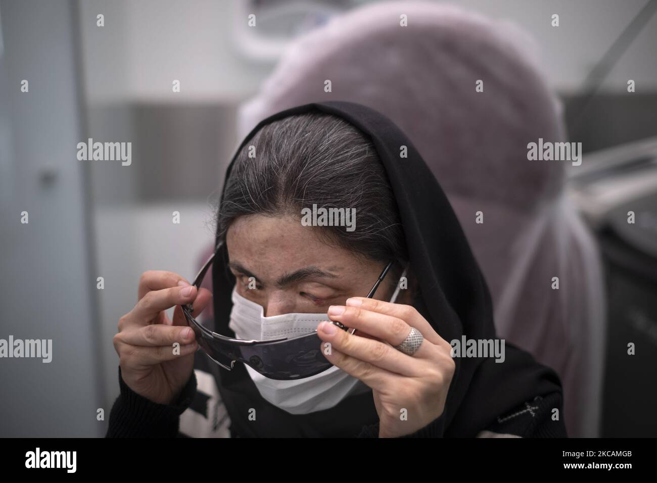 Masoumeh Ataei, who is a victim of an acid attack, wears her sunglasses ...
