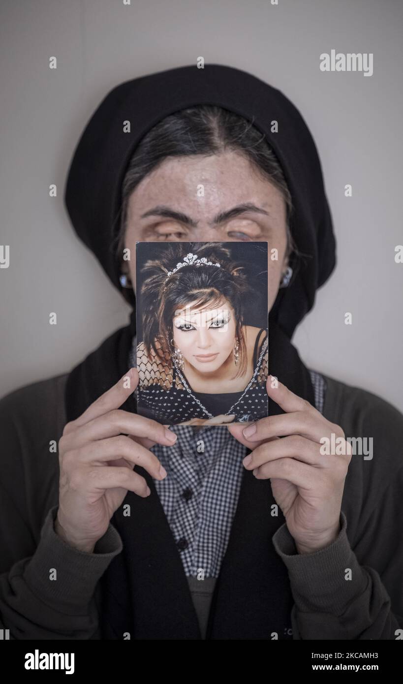 Masoumeh Ataei, who is a victim of an acid attack holds her portrait ...