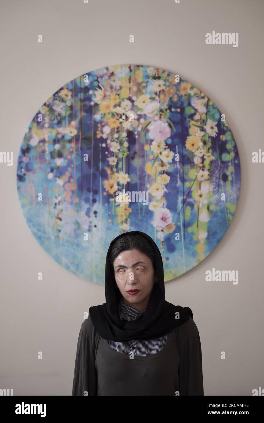 Masoumeh Ataei, who is a victim of an acid attack poses for a ...