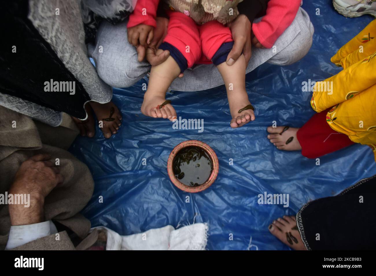 Kashmiri people take leech therapy on the eve of Nauroz (Persian New ...
