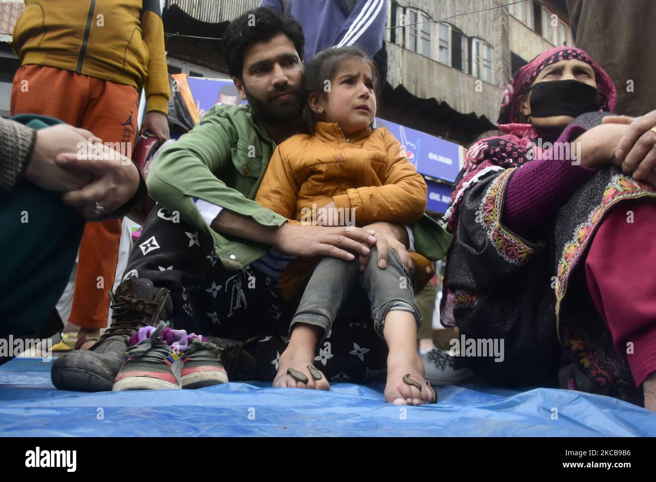 Kashmiri people take leech therapy on the eve of Nauroz (Persian New ...