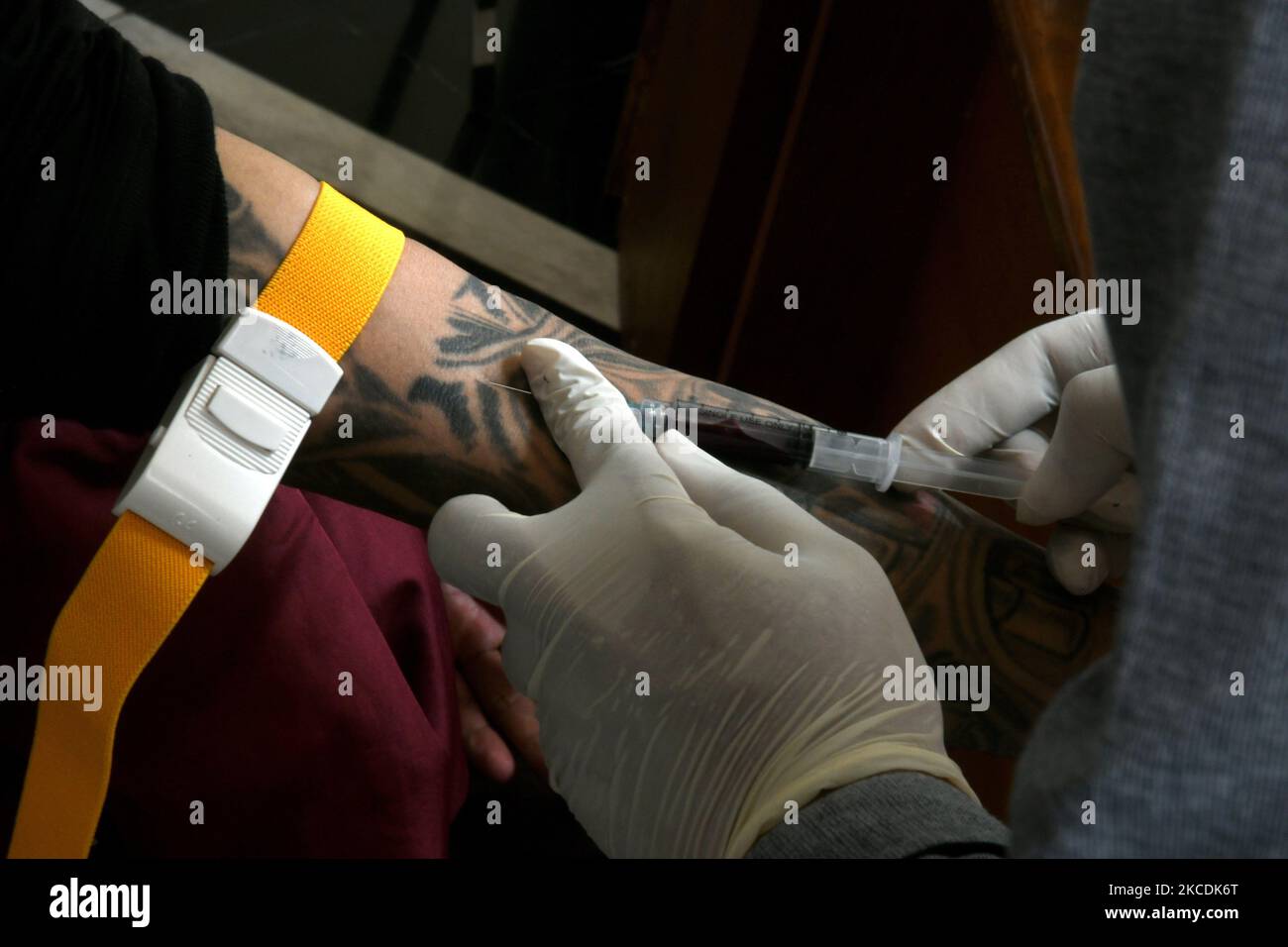 Participants take part in a free tattoo removal program at the Baitul ...