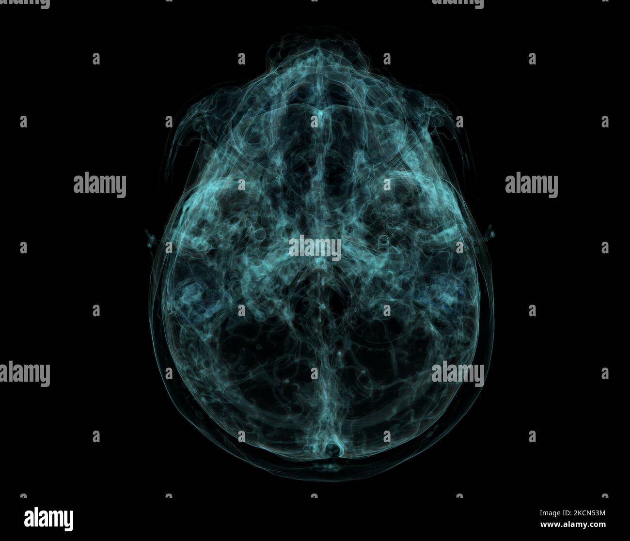 Human base of Skull, Brain by CT Scan. X-ray Visualization Inside Of Skull. 3D Illustration ...
