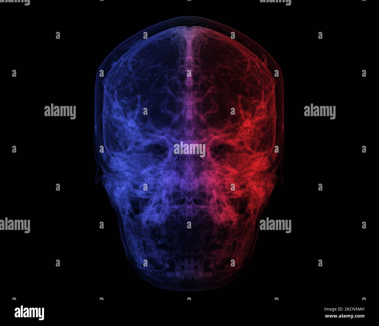 Human Skull, Brain by CT Scan. X-ray Visualization Inside Of Skull. 3D ...