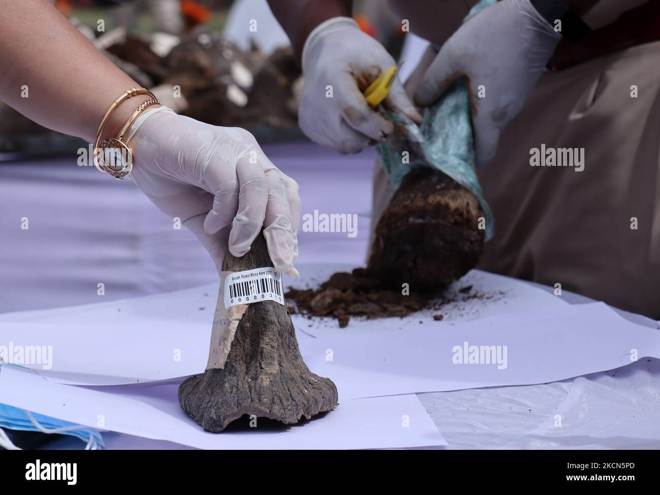 Burn mark on hand hi-res stock photography and images - Alamy