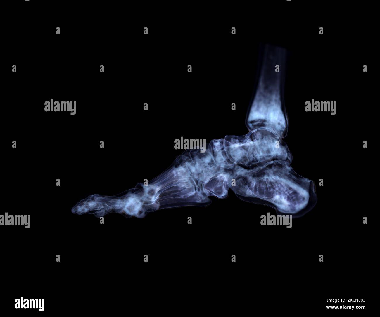 3D rendering of the foot bones for diagnosis bone fracture and ...