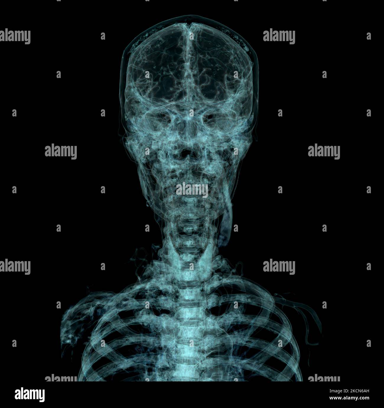 Human Skull, Brain by CT Scan. X-ray Visualization Inside Of Skull. 3D ... Human Skull, Brain by CT Scan. X-ray Visualization Inside Of Skull. 3D ...