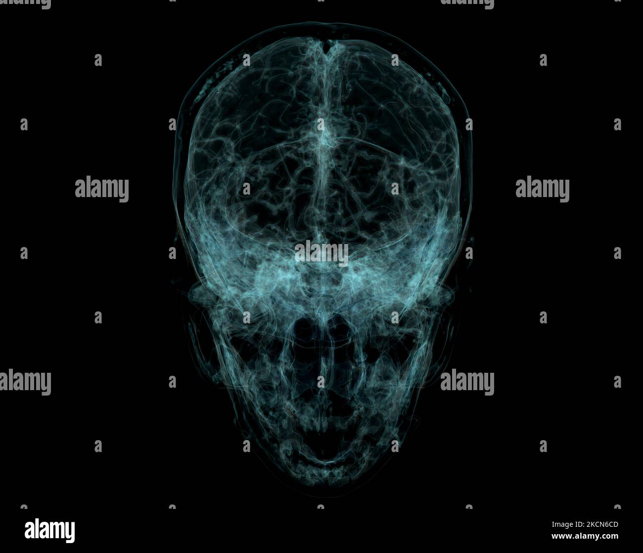 Human Skull, Brain by CT Scan. X-ray Visualization Inside Of Skull. 3D ...
