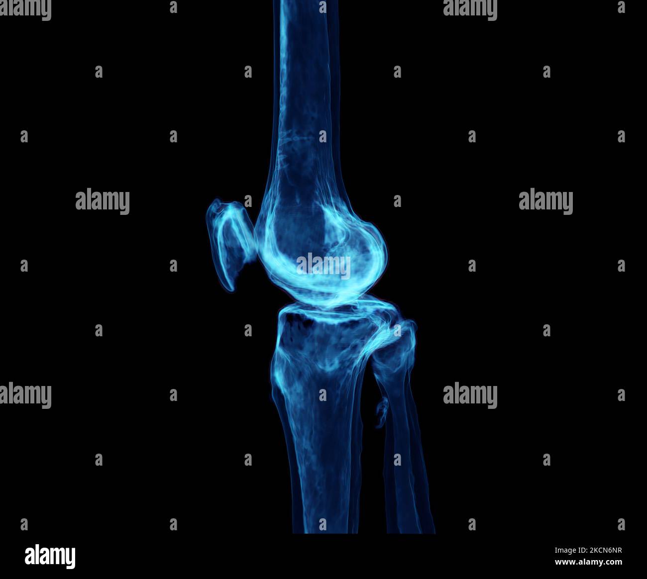 3d renderering of the knee joint isolated on black background Showing ...