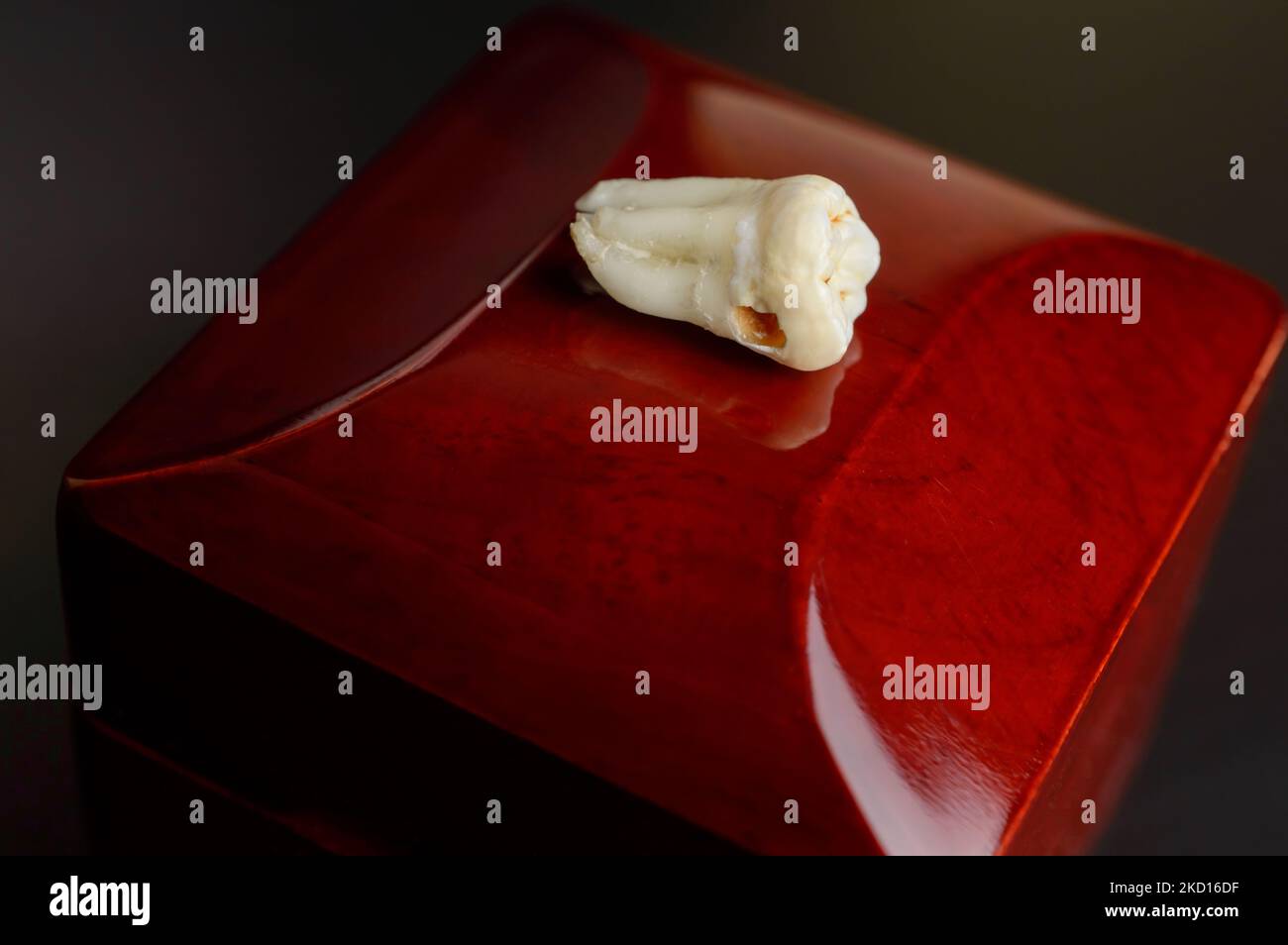 Wisdom tooth extraction hi-res stock photography and images - Alamy