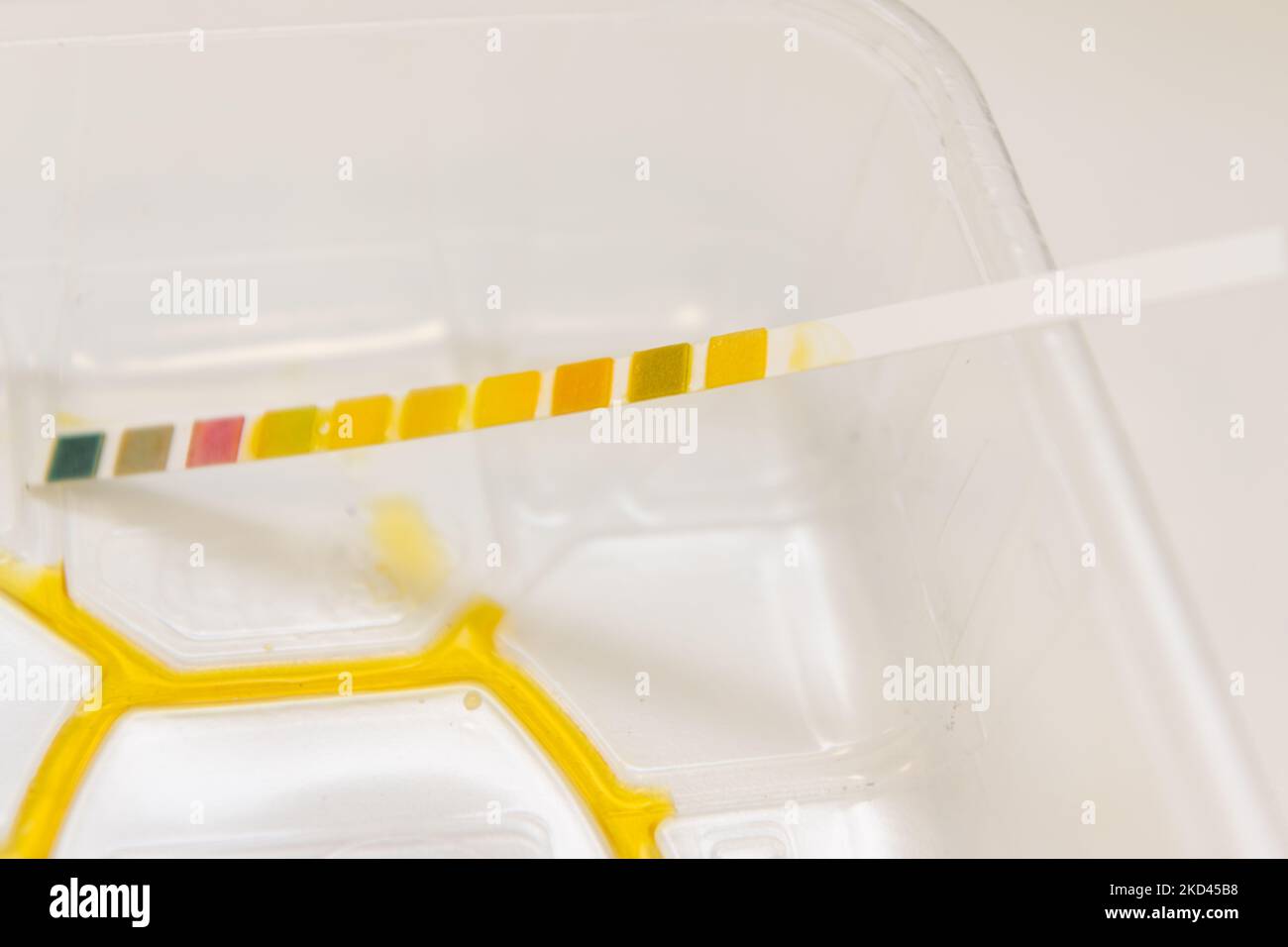 a urine sample with test strip waiting for evaluation Stock Photo - Alamy