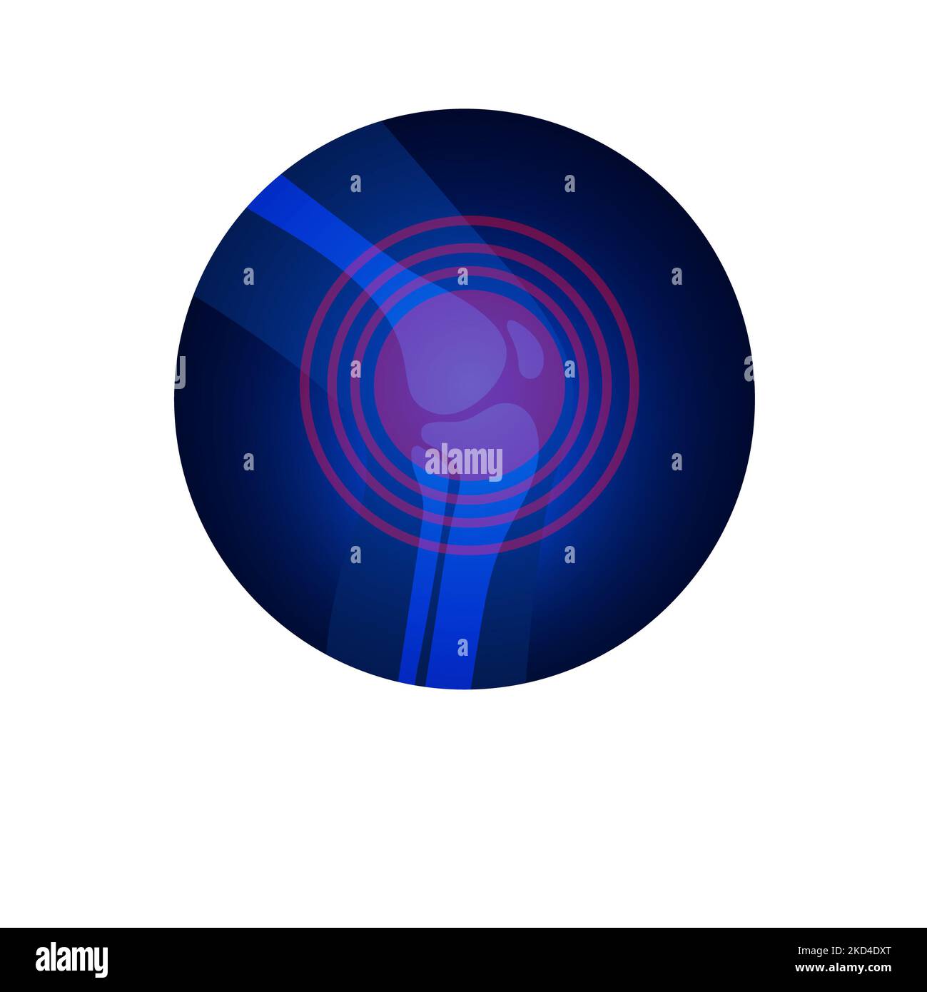 Ray knee joint pain Cut Out Stock Images & Pictures - Alamy