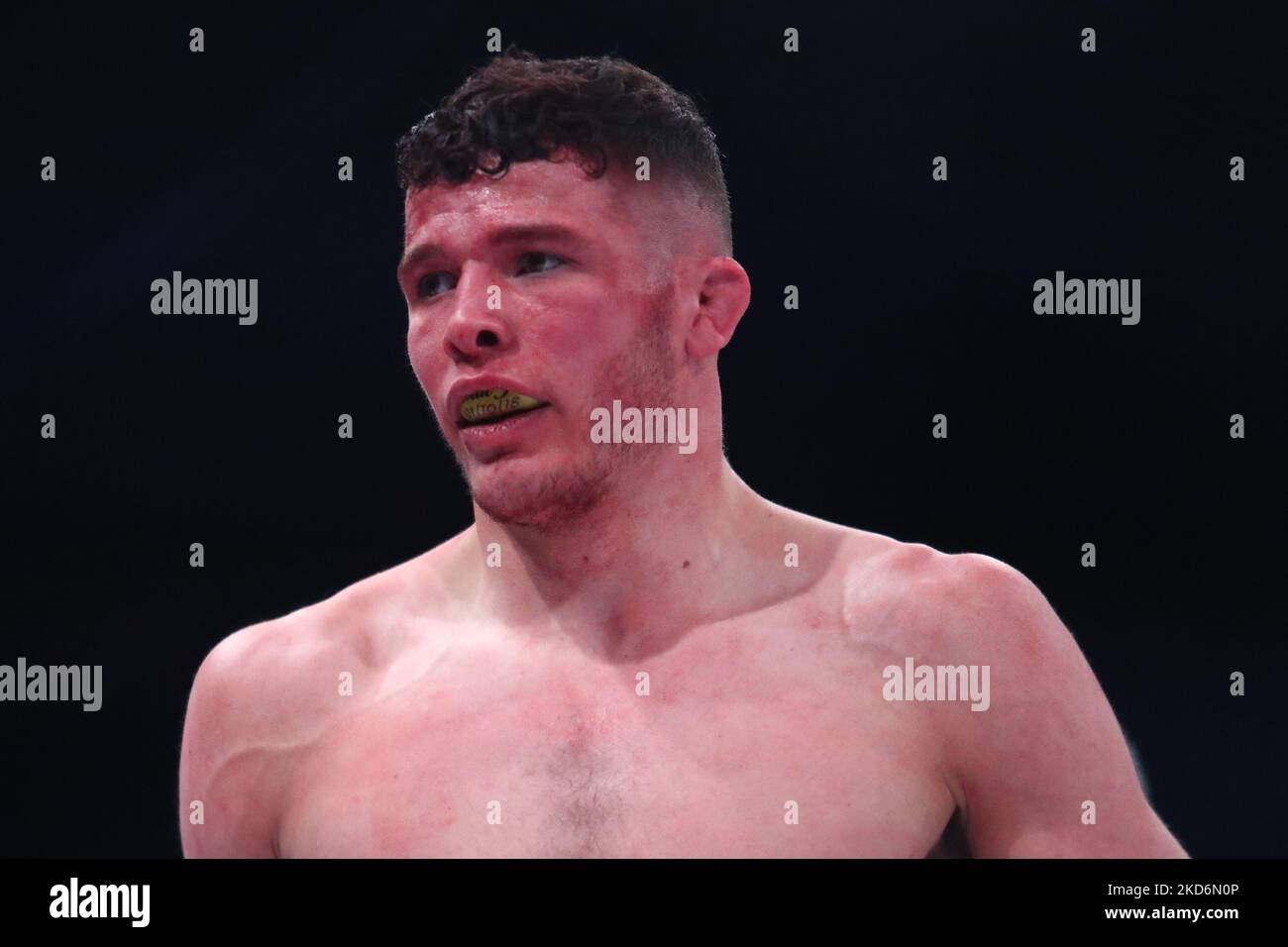 Connor Hitchens reacts between rounds during his featherweight bout ...