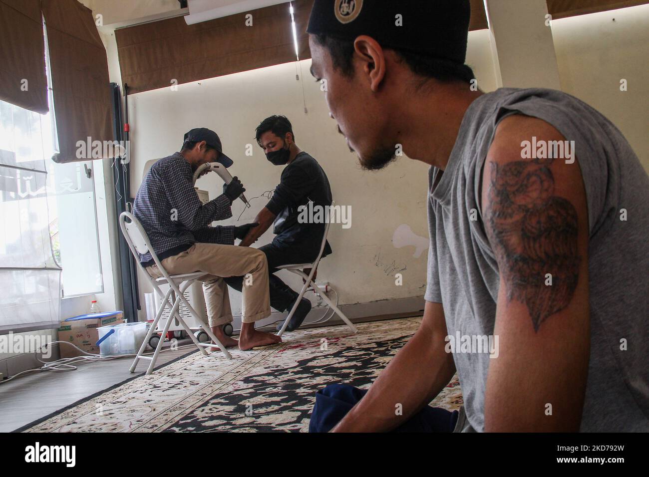 Free tattoo removal program hi-res stock photography and images - Alamy