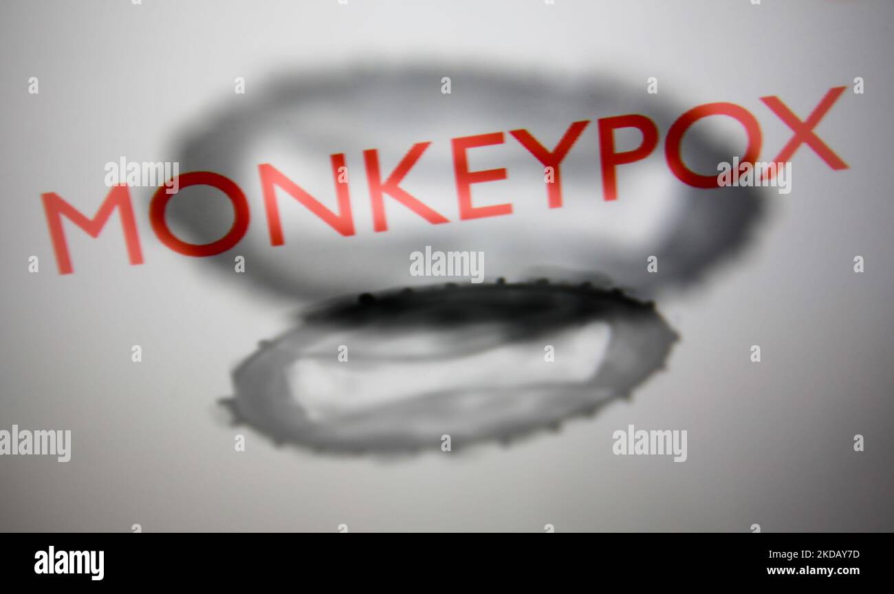 'Monkeypox' sign and monkeypox illustrative models displayed on a ...