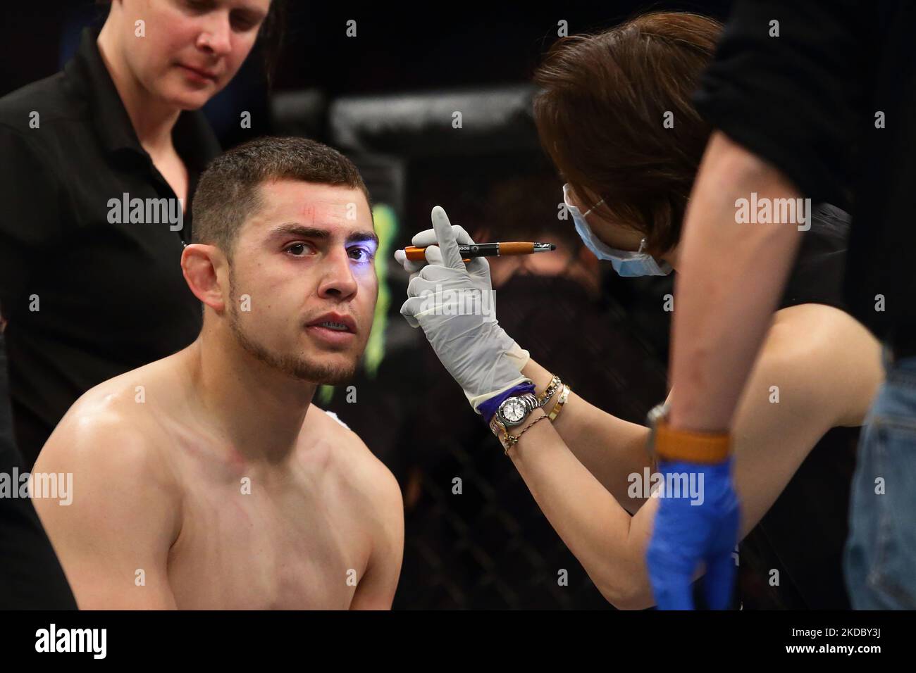 A doctor attends to Steve Garcia of United States after losing to ...