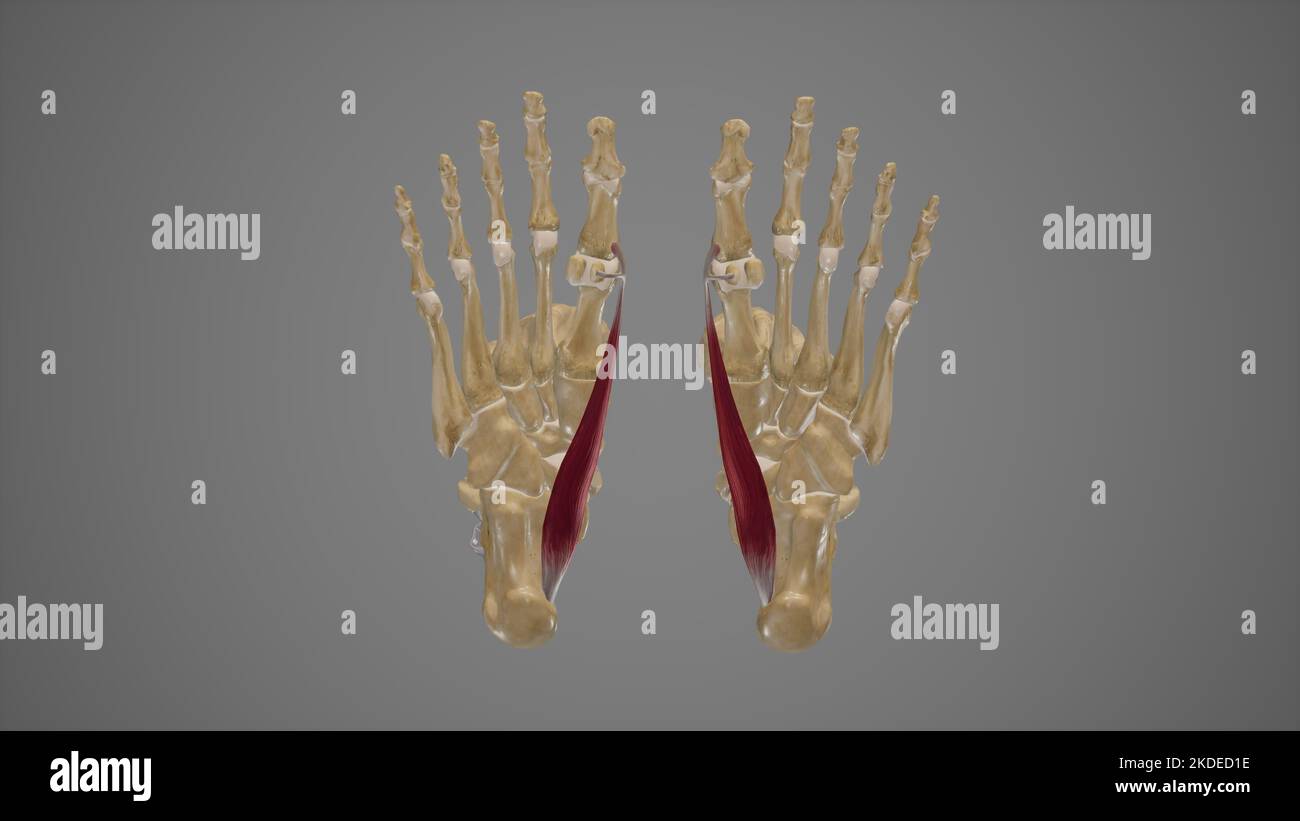 Abductor Hallucis Mri